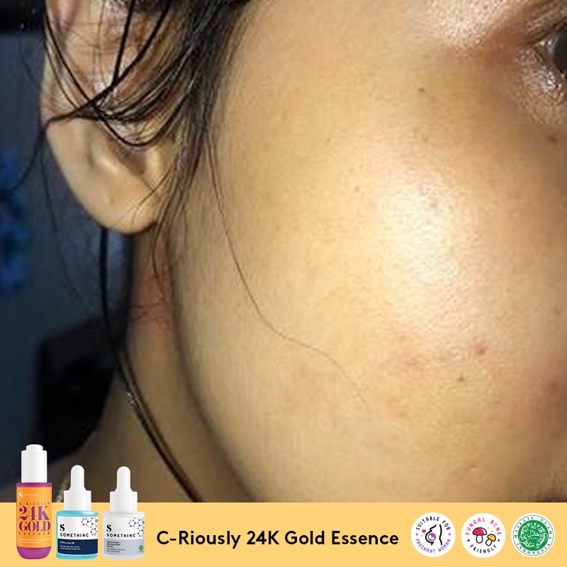 CRIOUSLY 24K GOLD Essence | SOMETHINC